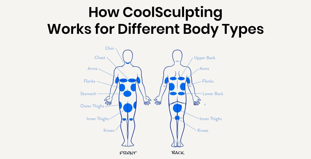 How CoolSculpting® Works for Different Body Types in Edmonton ...